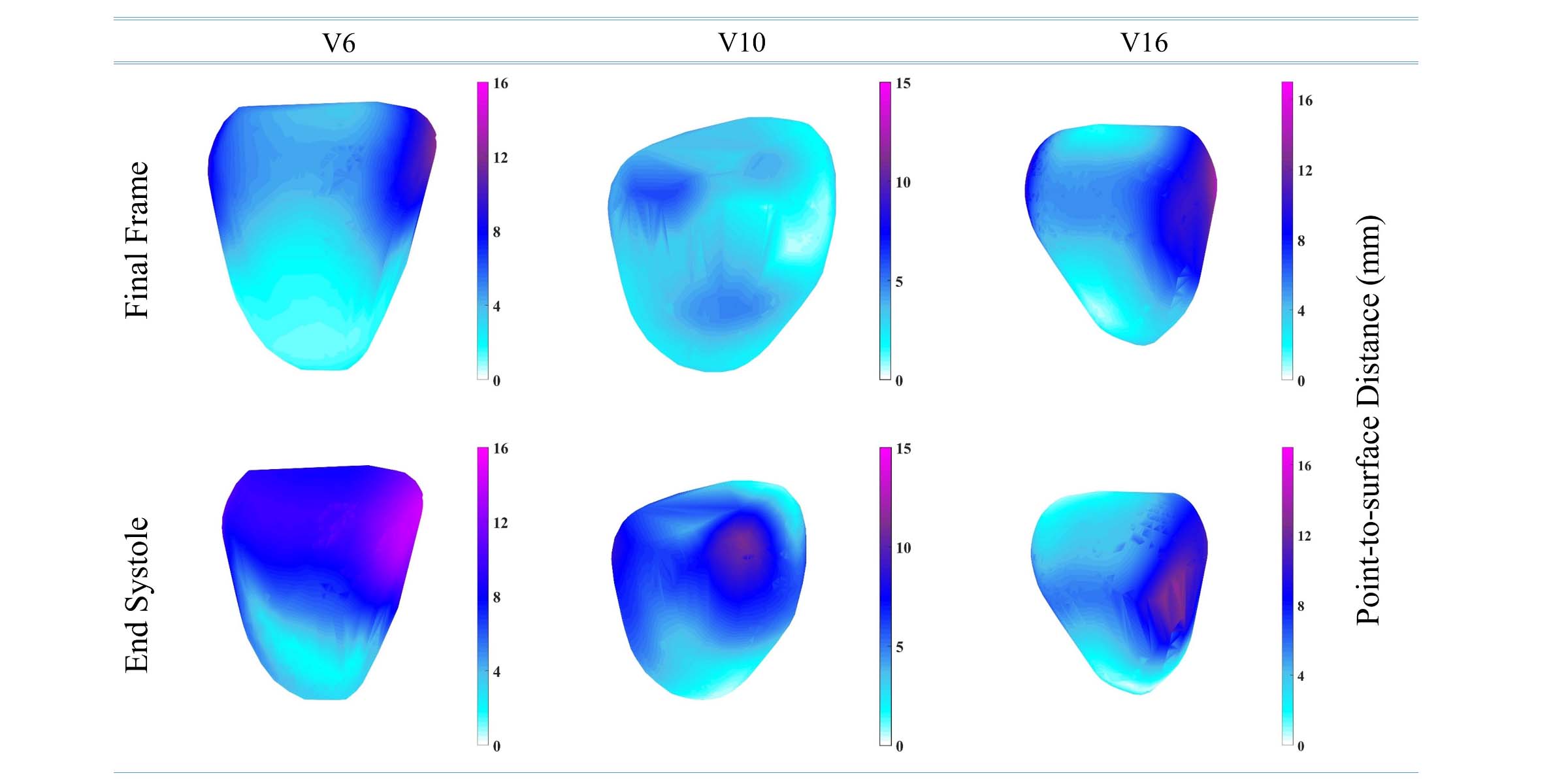 New MRI technique can identify scar muscles of heart without damaging ...