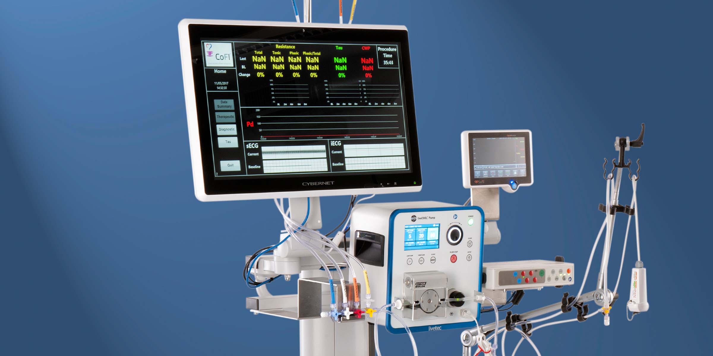 CorFlow Therapeutics receive Breakthrough Device Designation for PCI ...