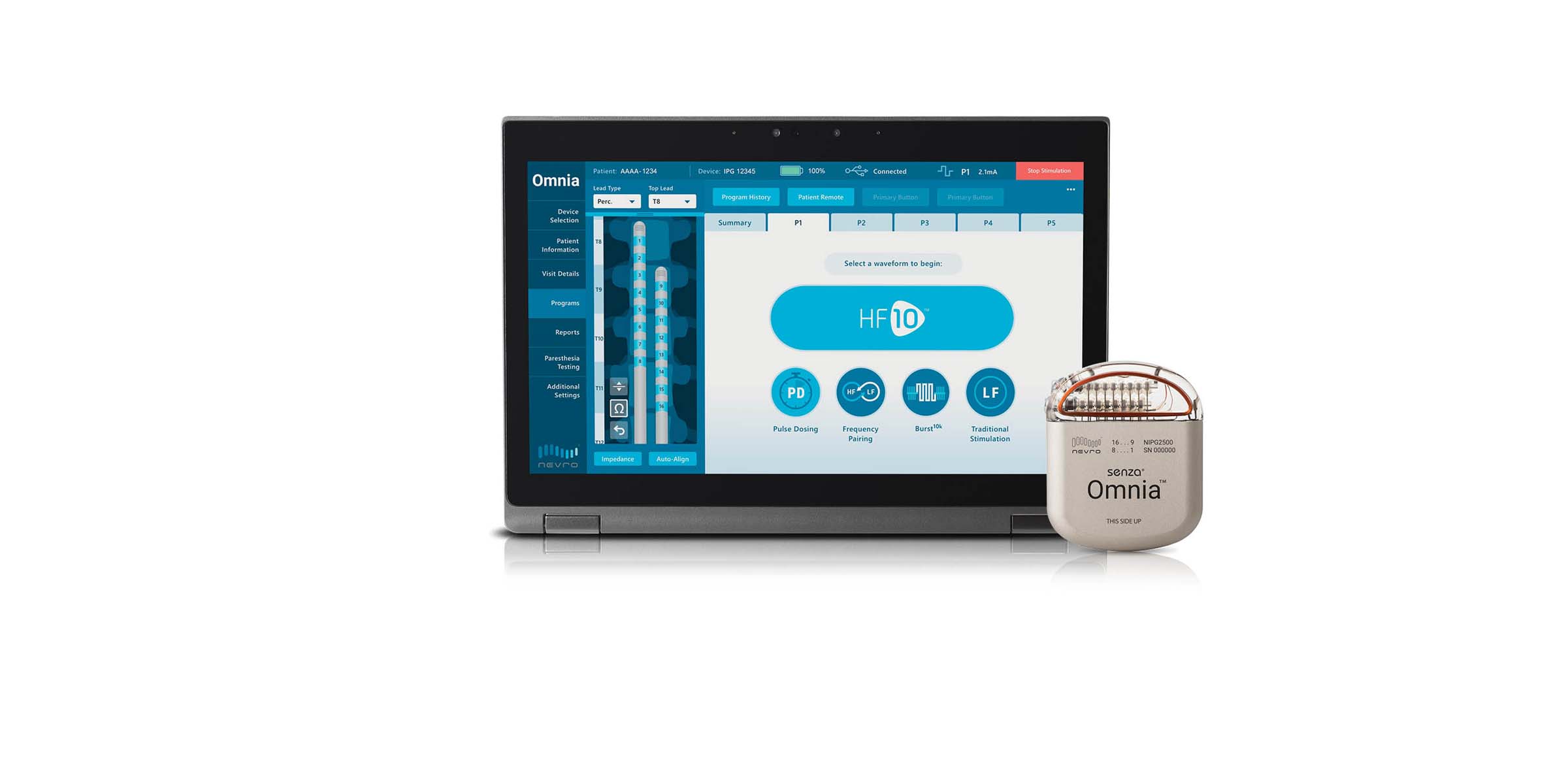 AHA 2019: Positive data for Cordella PA pressure sensor system – BIBA ...