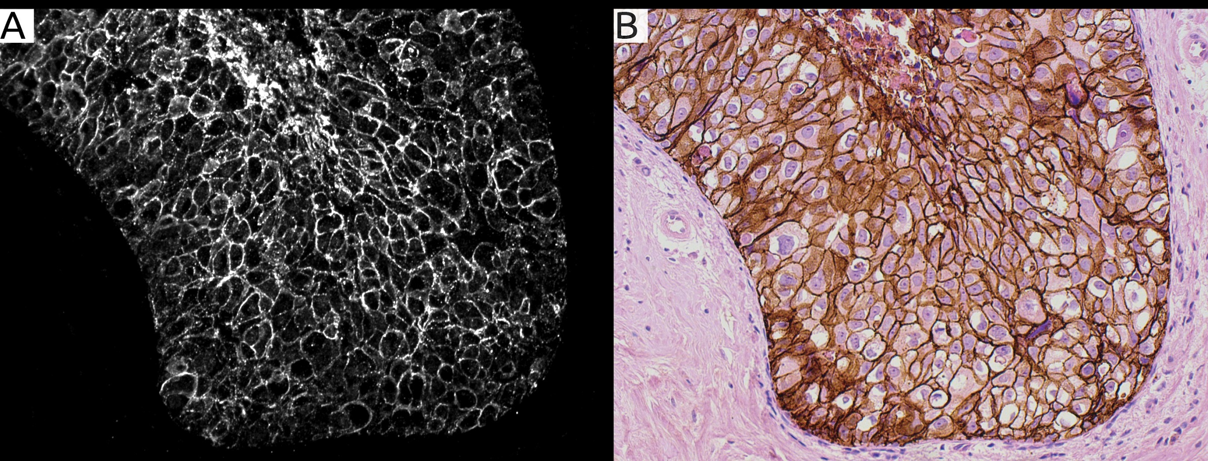 New technology for digital tissue diagnostics is increasing accuracy ...
